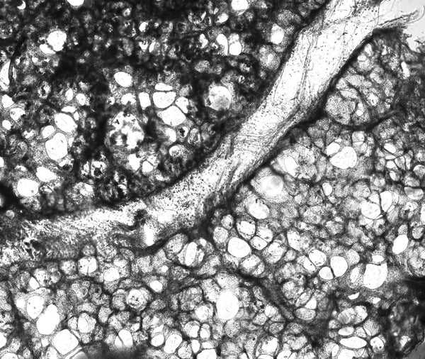 Human Precision-Cut Lung Slice (PCLS-001E) – 17, Male, Hispanic – Cell ...