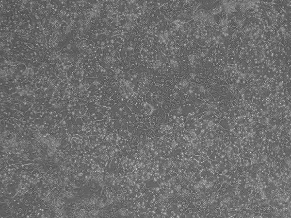 Human Plateable Hepatocytes (HEP-001A) (Viability: 80%, Confluency: 90 ...