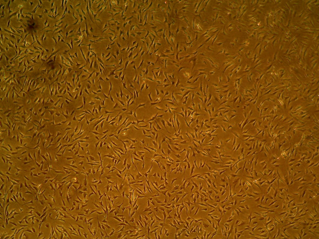 Human Retinal Endothelial & Pericyte Cells | ACBRI 181 & 183 | Cell Systems