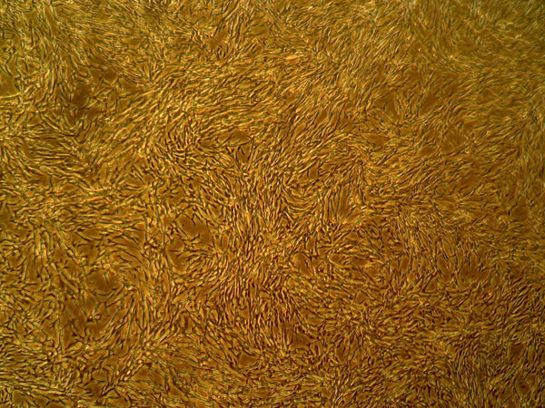 Primary Human Cardiac Fibroblast Cells - Cell Systems