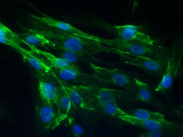 Primary Human Retinal Pericyte Cells - Cell Systems