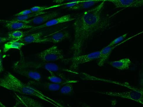 Primary Human Cardiac Fibroblast Cells - Cell Systems
